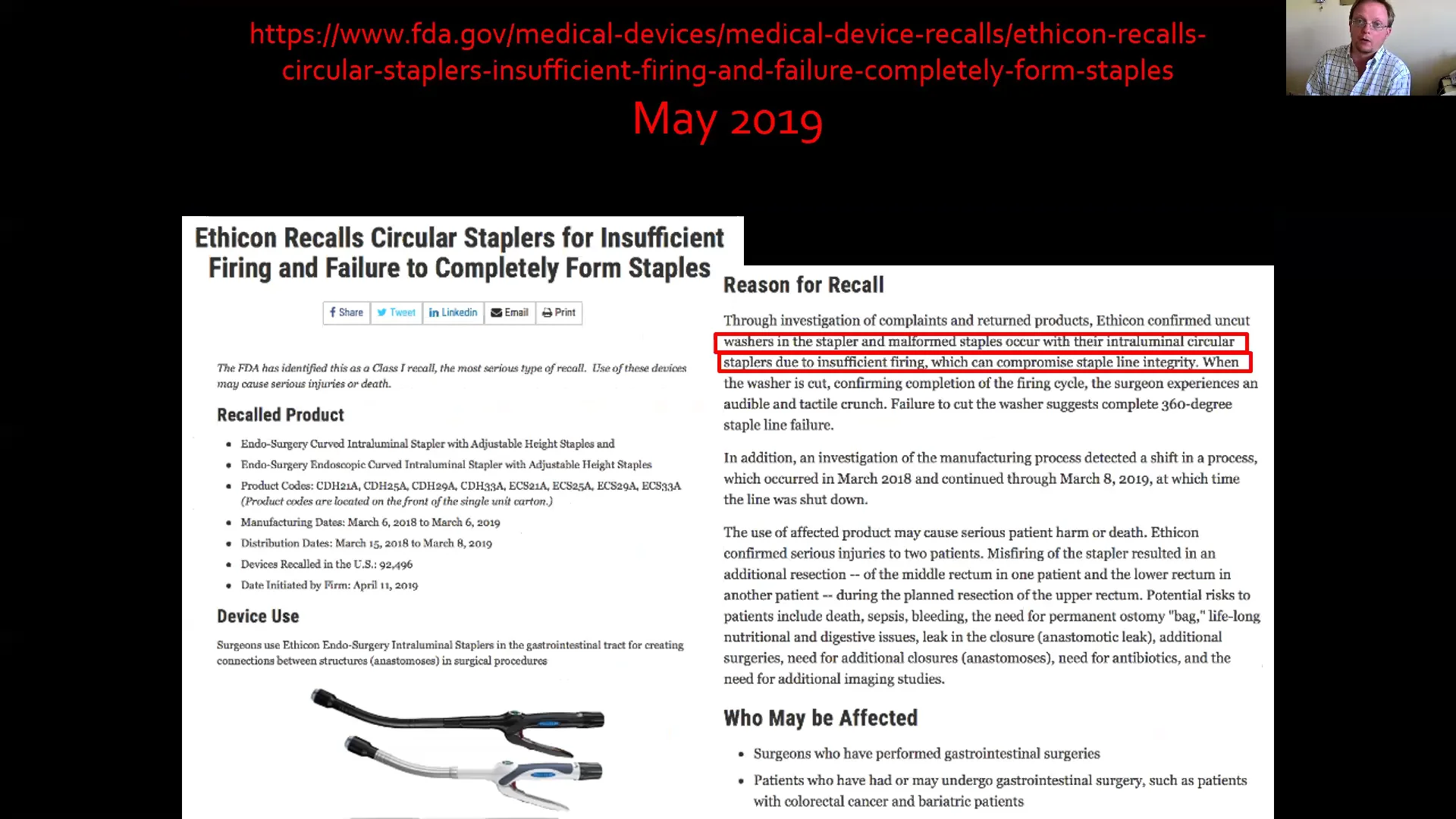 Anastomotic Mishaps, from Stapler Misfire to Anastomotic Leaks on Vimeo