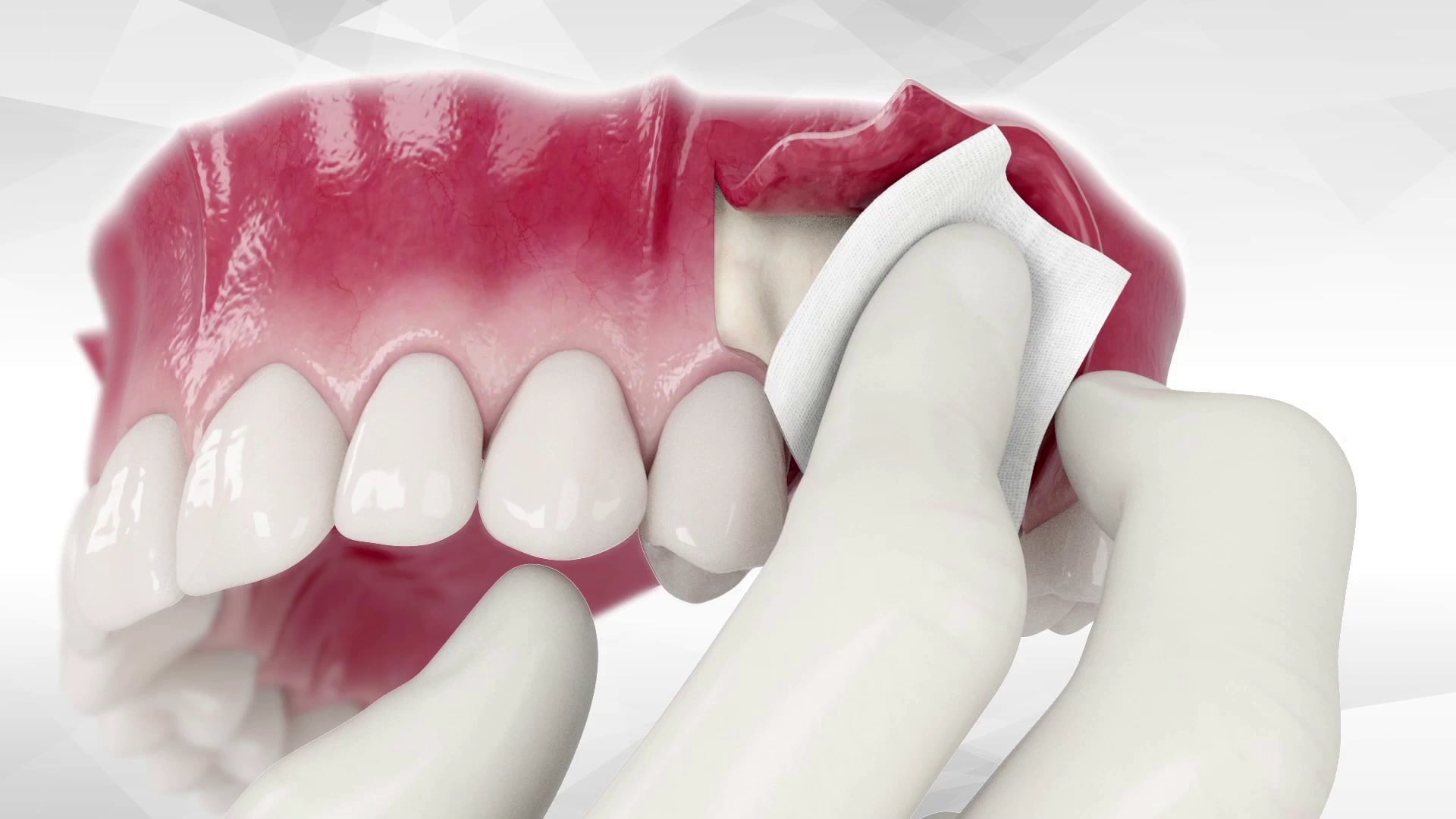 Open Sinus Lift Animated on Vimeo