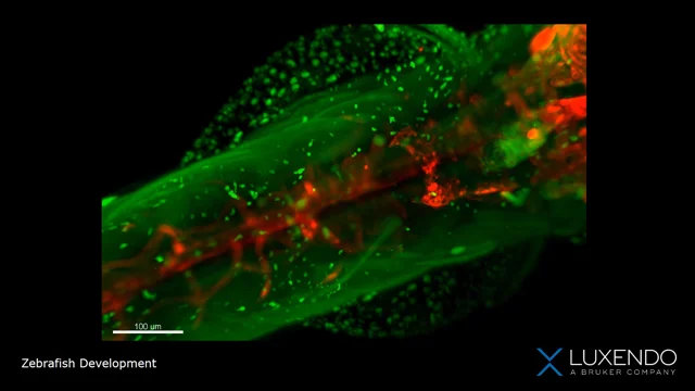 Light Sheet Microscopy Zebrafish Development | Shelly Lighting