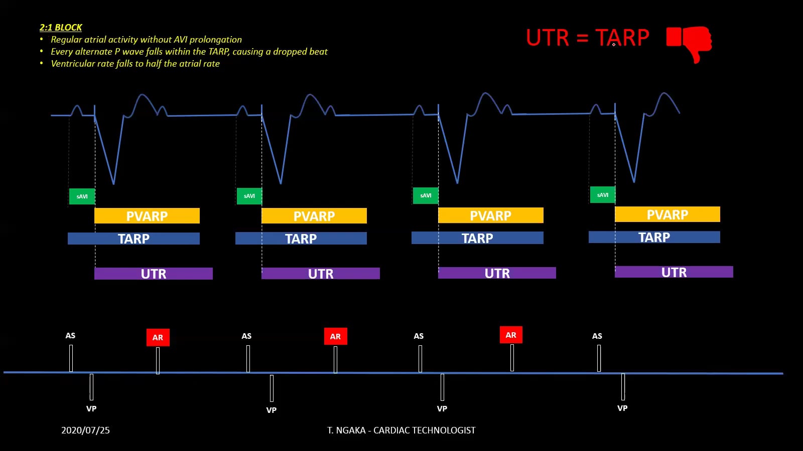TIMING CYCLES - UPPER RATE BEHAVIOUR (PART ONE) on Vimeo