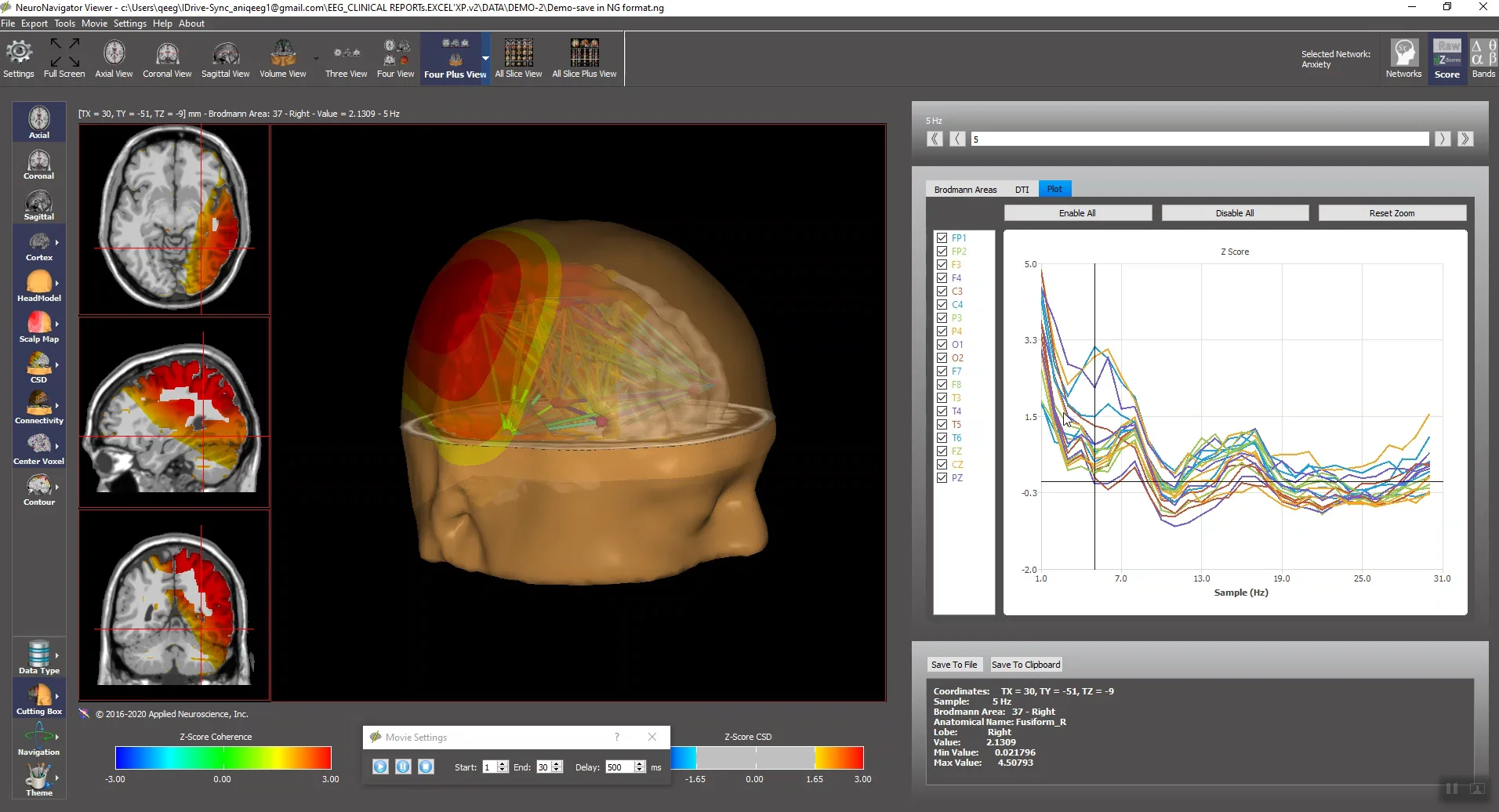 NeuroNavigator with Dynamic FFT-Video2