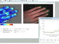 Laser Speckle Contrast Imager - moorFLPI-2 - Moor Instruments