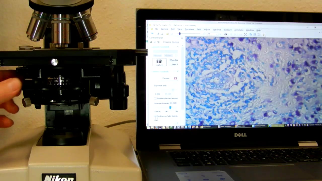How to Adjust Your Microscope Kohler Illumination on Vimeo