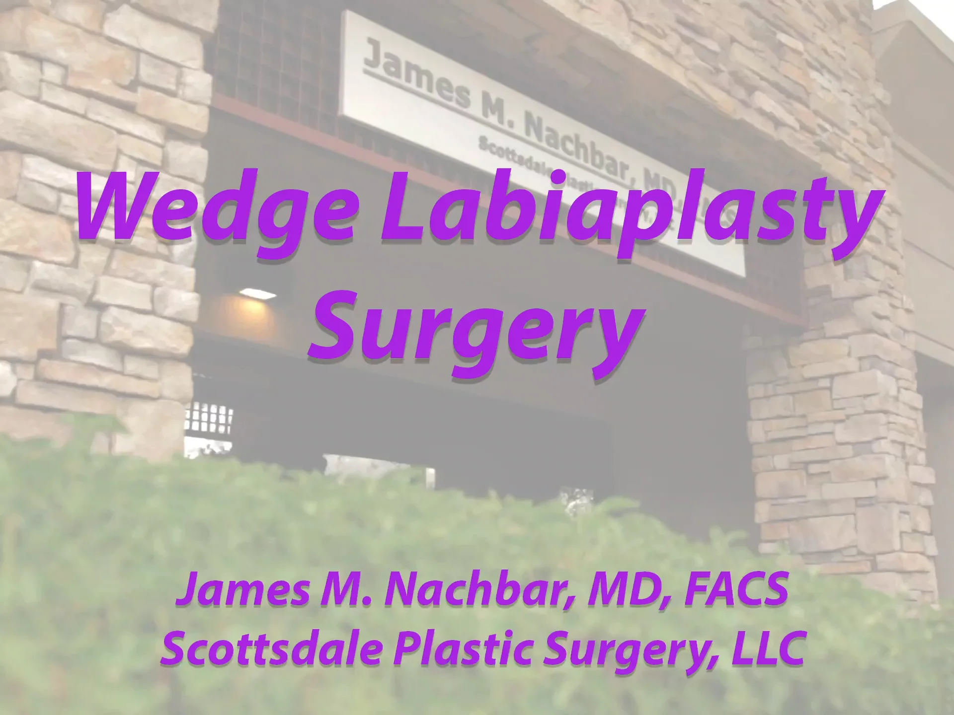 Wedge Labiaplasty Surgery Video