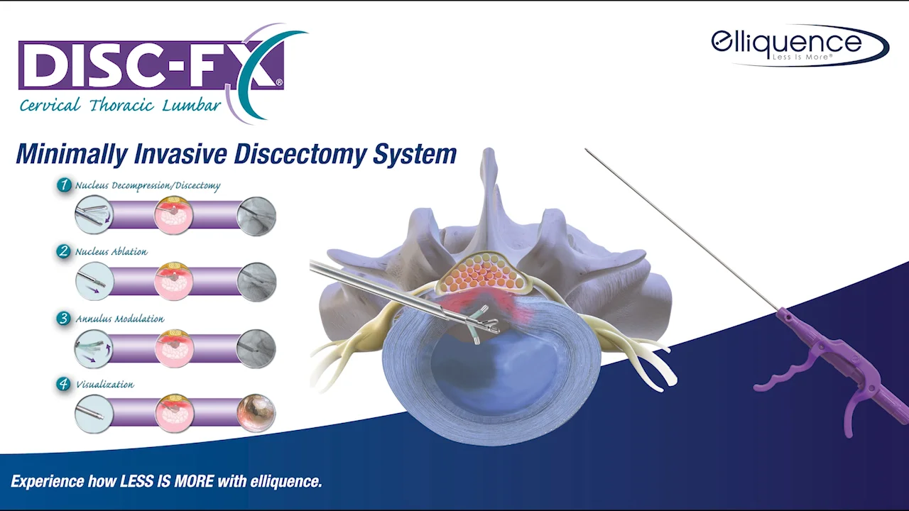 elliquence - Disc-FX