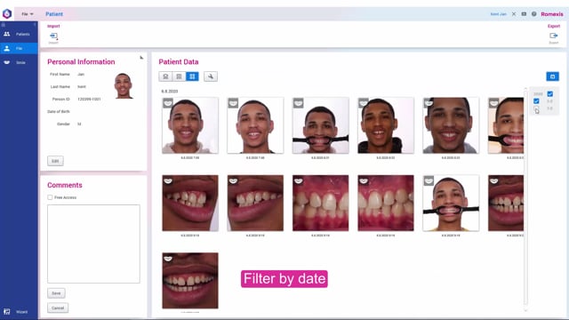 Planmeca Romexis Smile Design on Vimeo