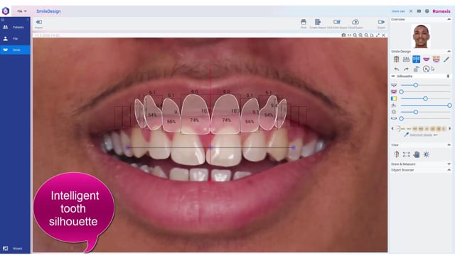 Planmeca Romexis Smile Design on Vimeo