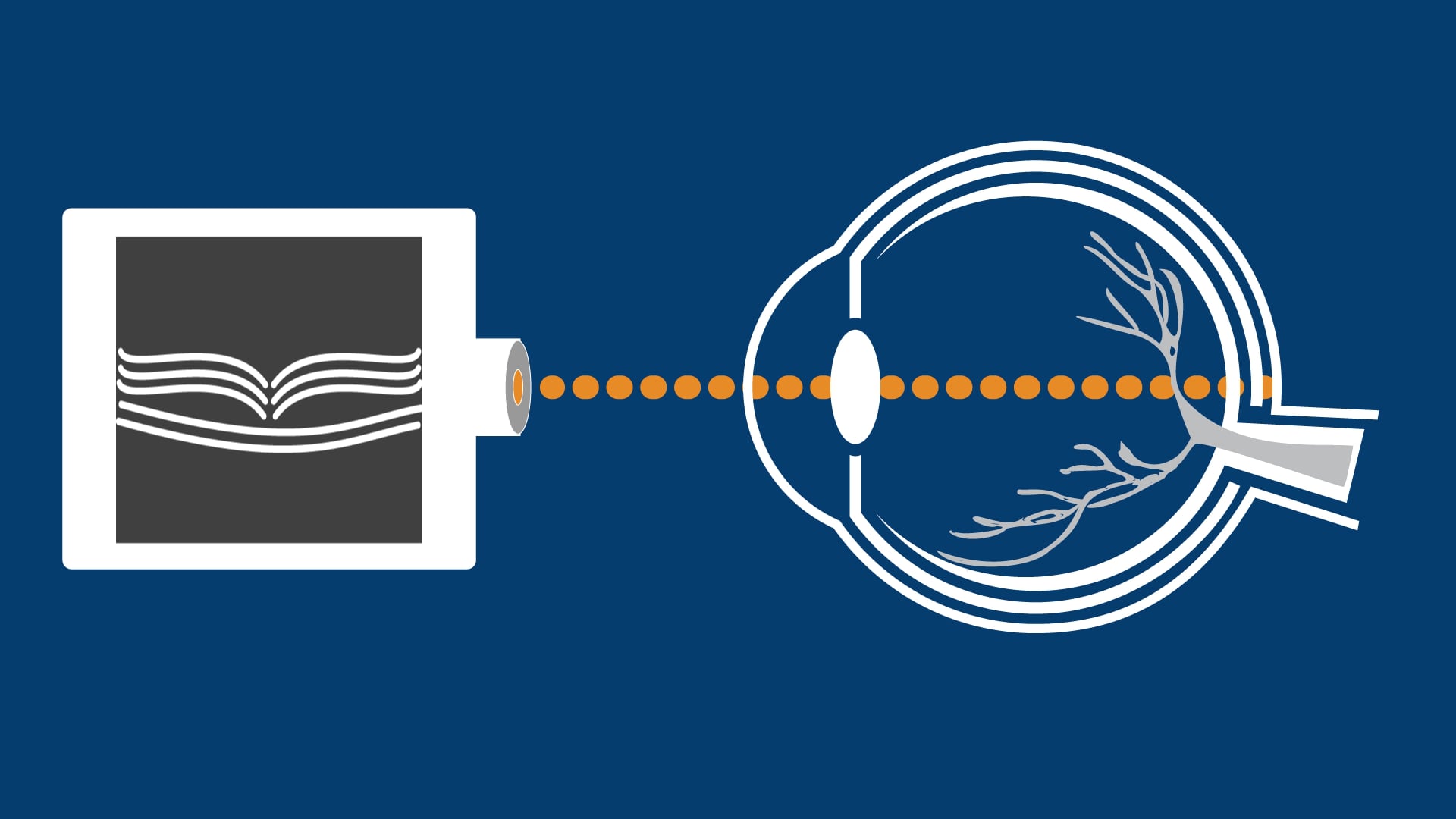 Artelus OCT Video V6 on Vimeo