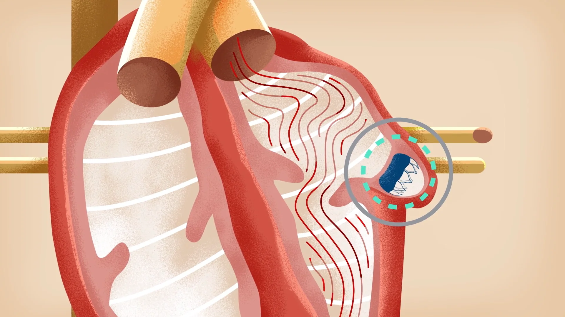 Watchman-Patient-Animation-60seconds