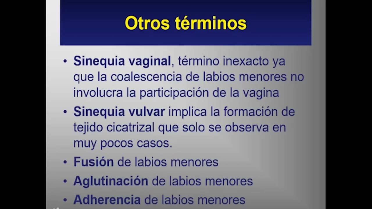 Coalescencia de labios menores en niñas Dra. Sandra Rivero on Vimeo