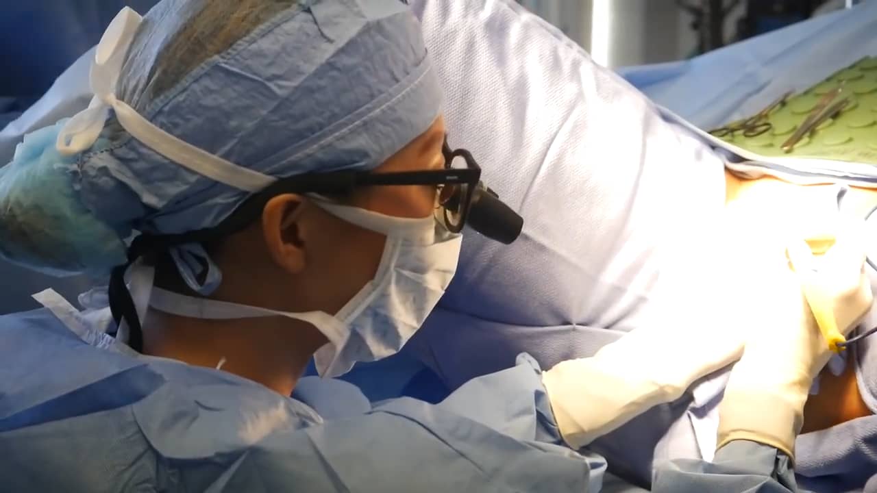 Perfect Vagina Surgery (Labiaplasty) With Beverly Hills Female Plastic ...