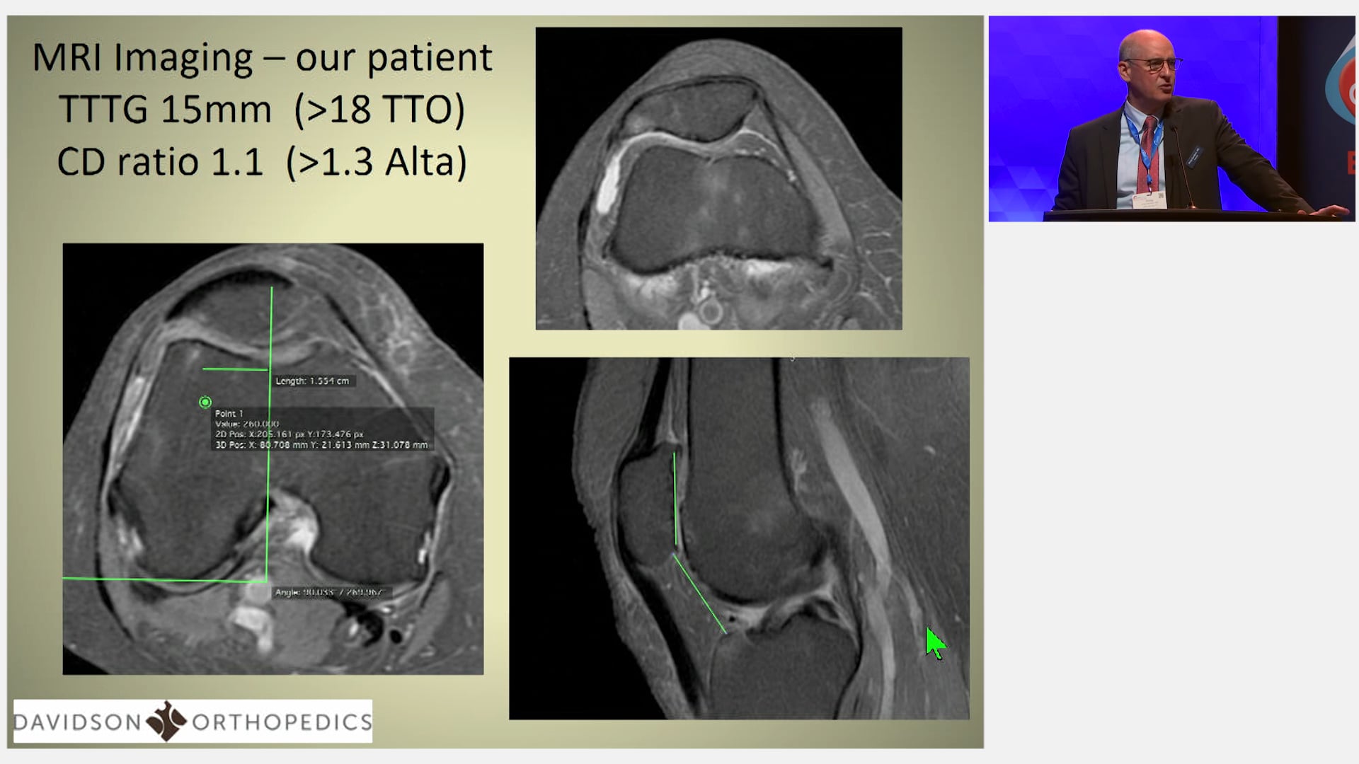 THURS GS - 52 - Evolving Technique- 38-Year-Old-Fire ghter With Pain ...