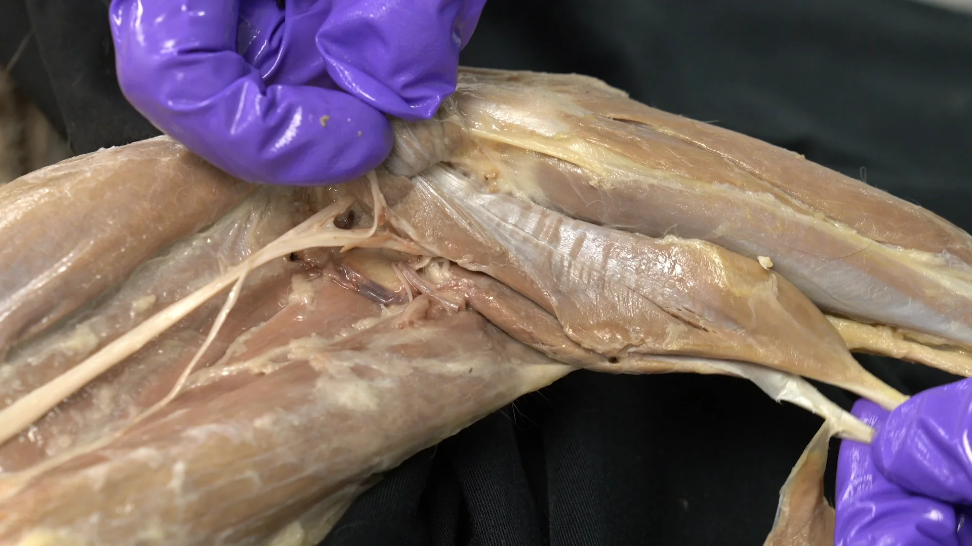 Block I Dissection - Dissection XVI—Crus Musculature on Vimeo