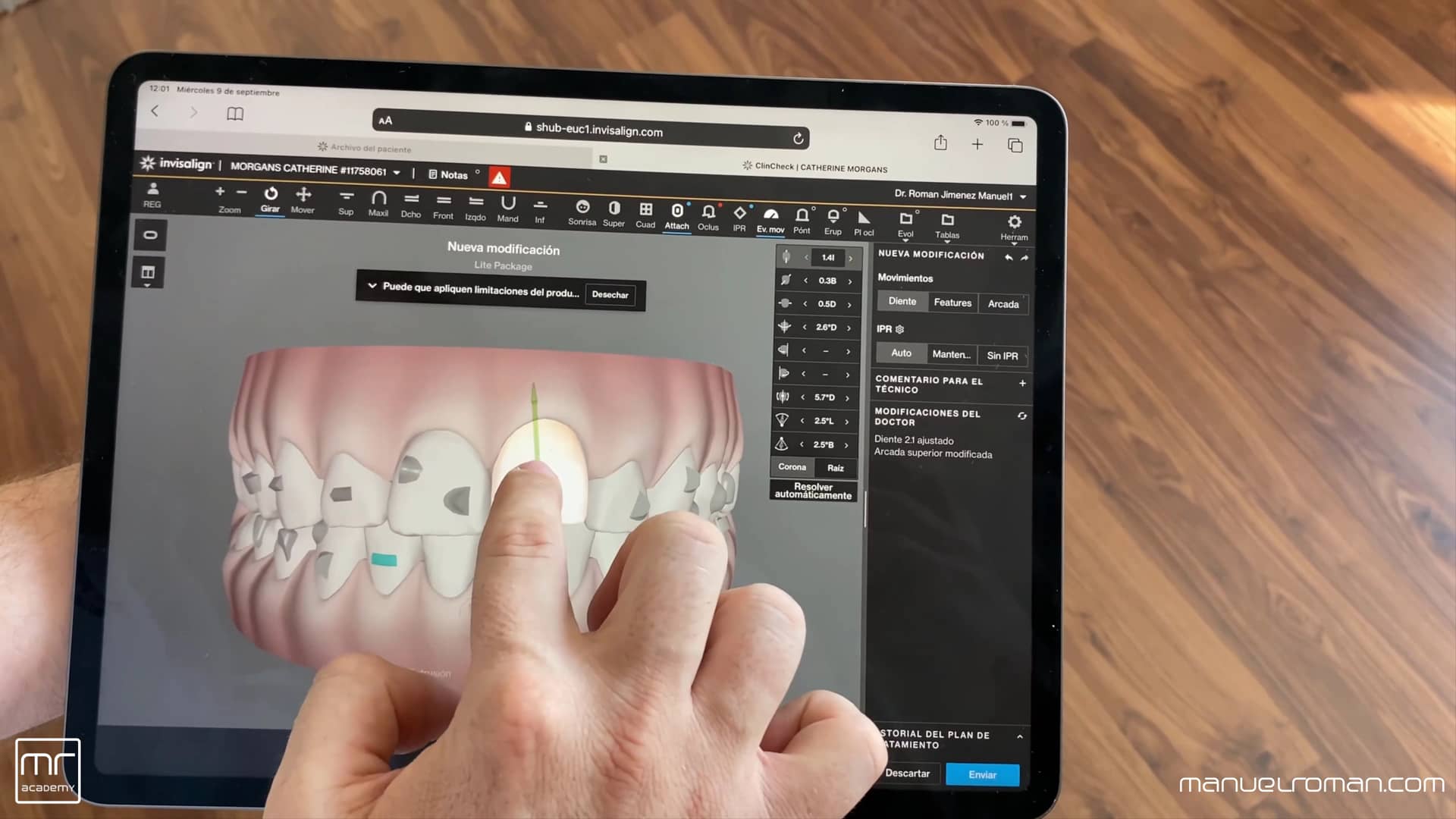 ClinCheck Pro 6.0 In-Face on Vimeo
