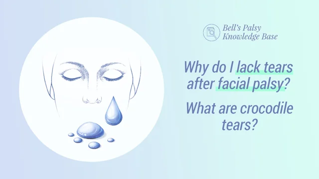 Crocodile Tears Syndrome