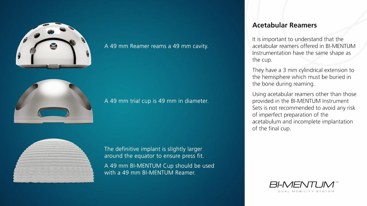 BI-MENTUM Surgical Technique and Instrument Guide on Vimeo