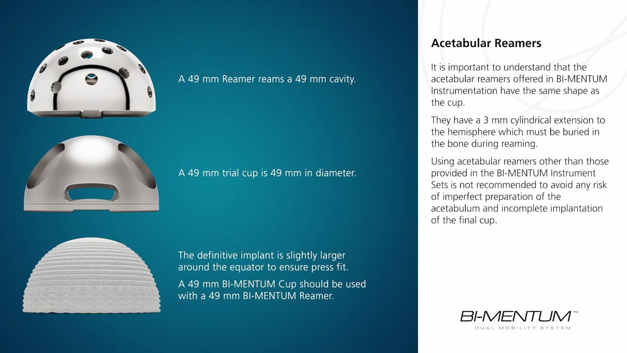 BI-MENTUM Surgical Technique and Instrument Guide on Vimeo