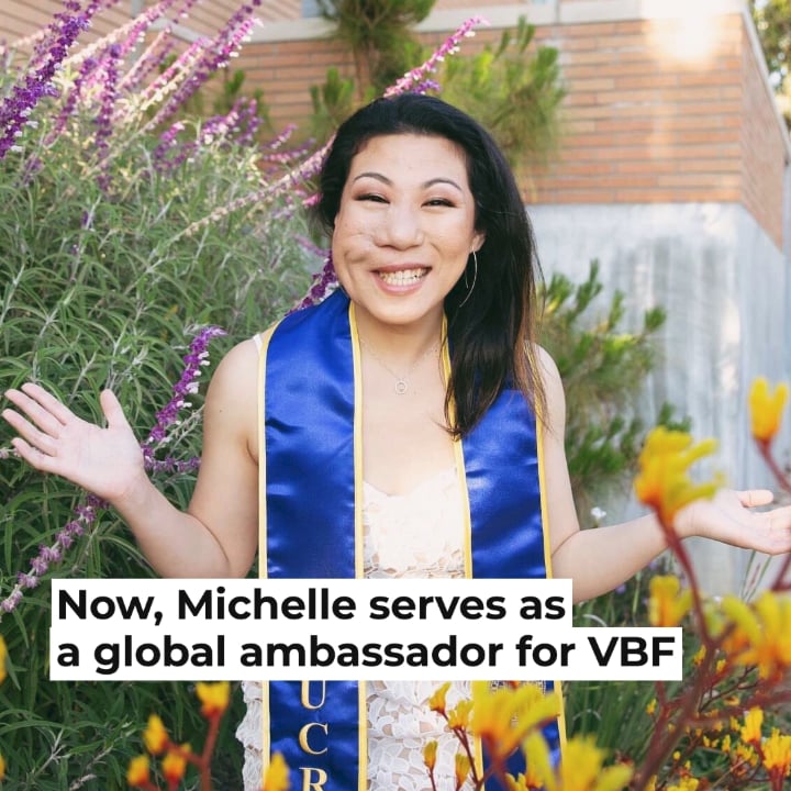 Michelle Lai's Story - Vascular Birthmark Foundation on Vimeo