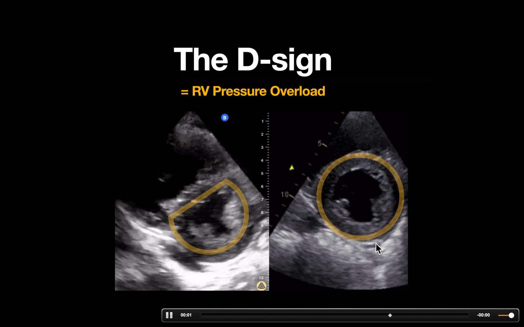 The D Sign on Vimeo