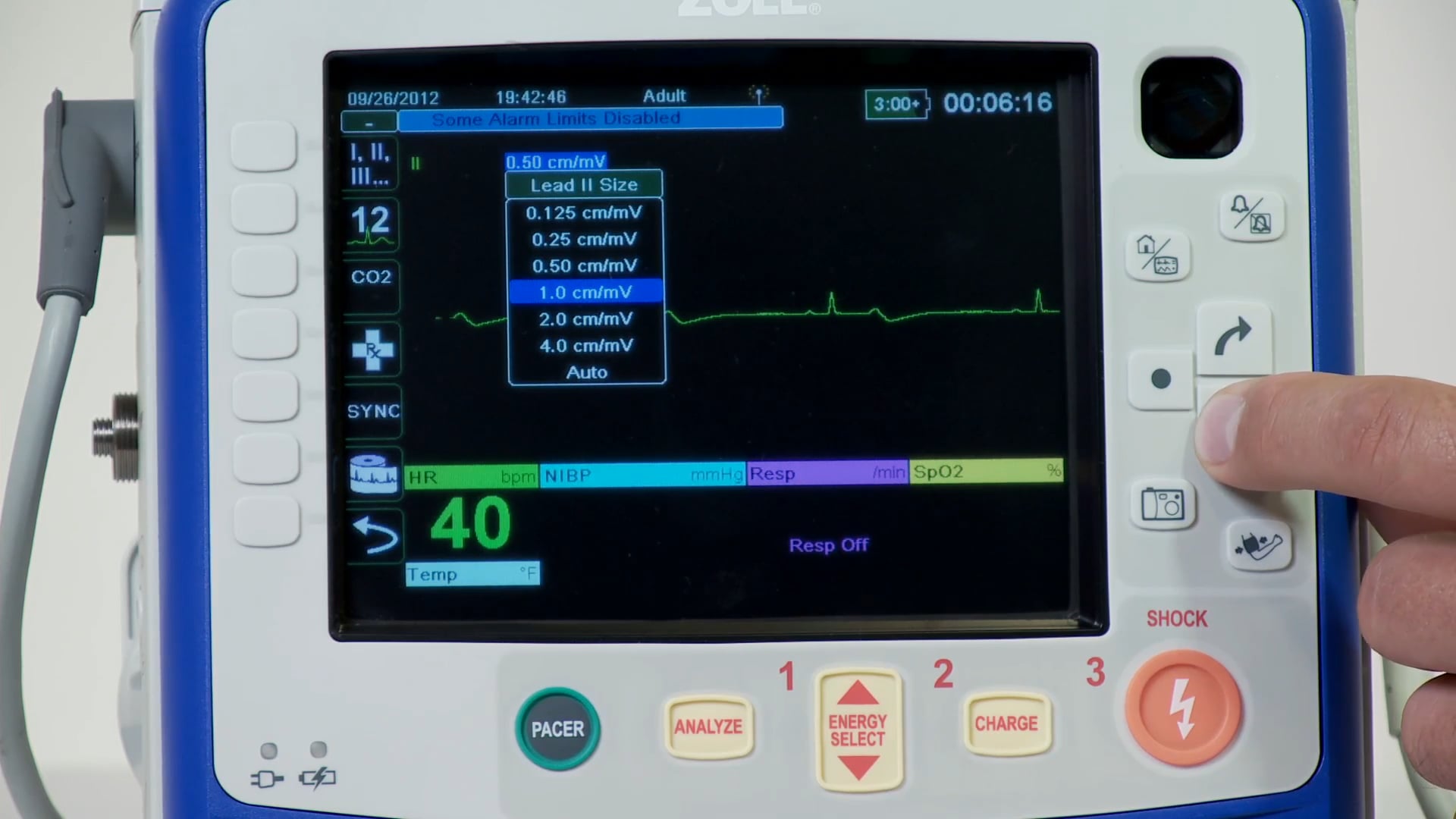 08 Zoll X Series ECG on Vimeo