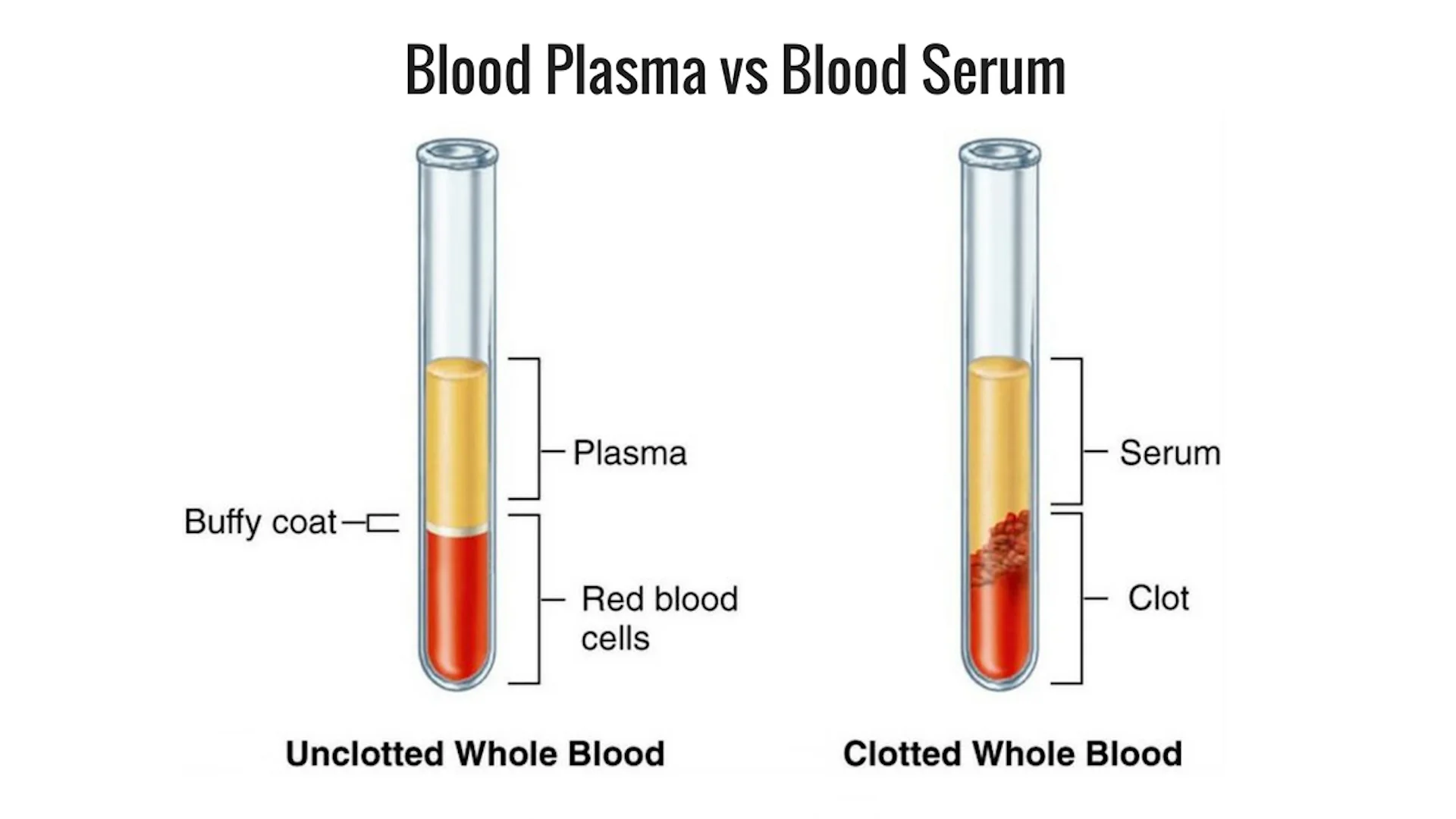 Course_57_Plasma_VS_Serum on Vimeo