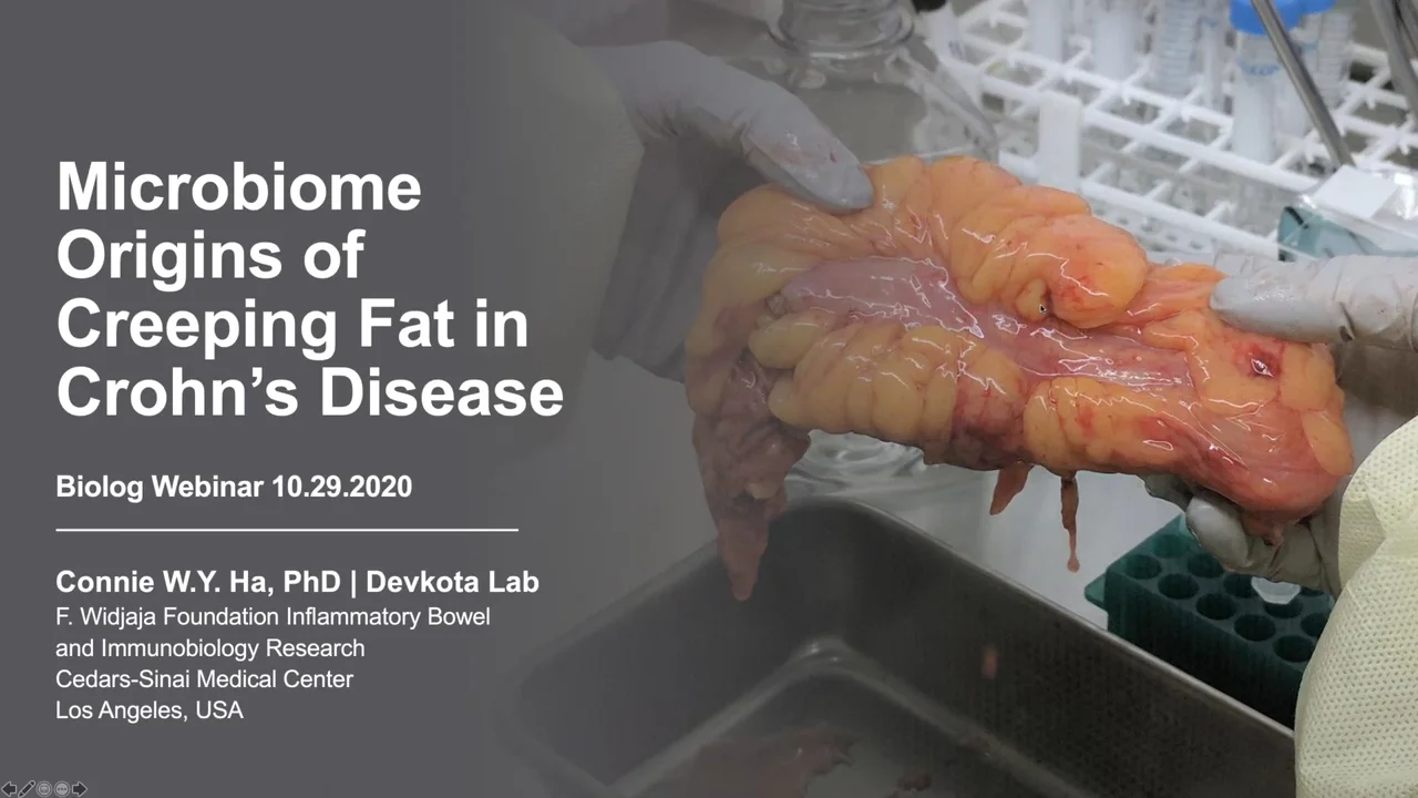 Microbiome Origins of Creeping Fat in Crohn’s Disease_Trim