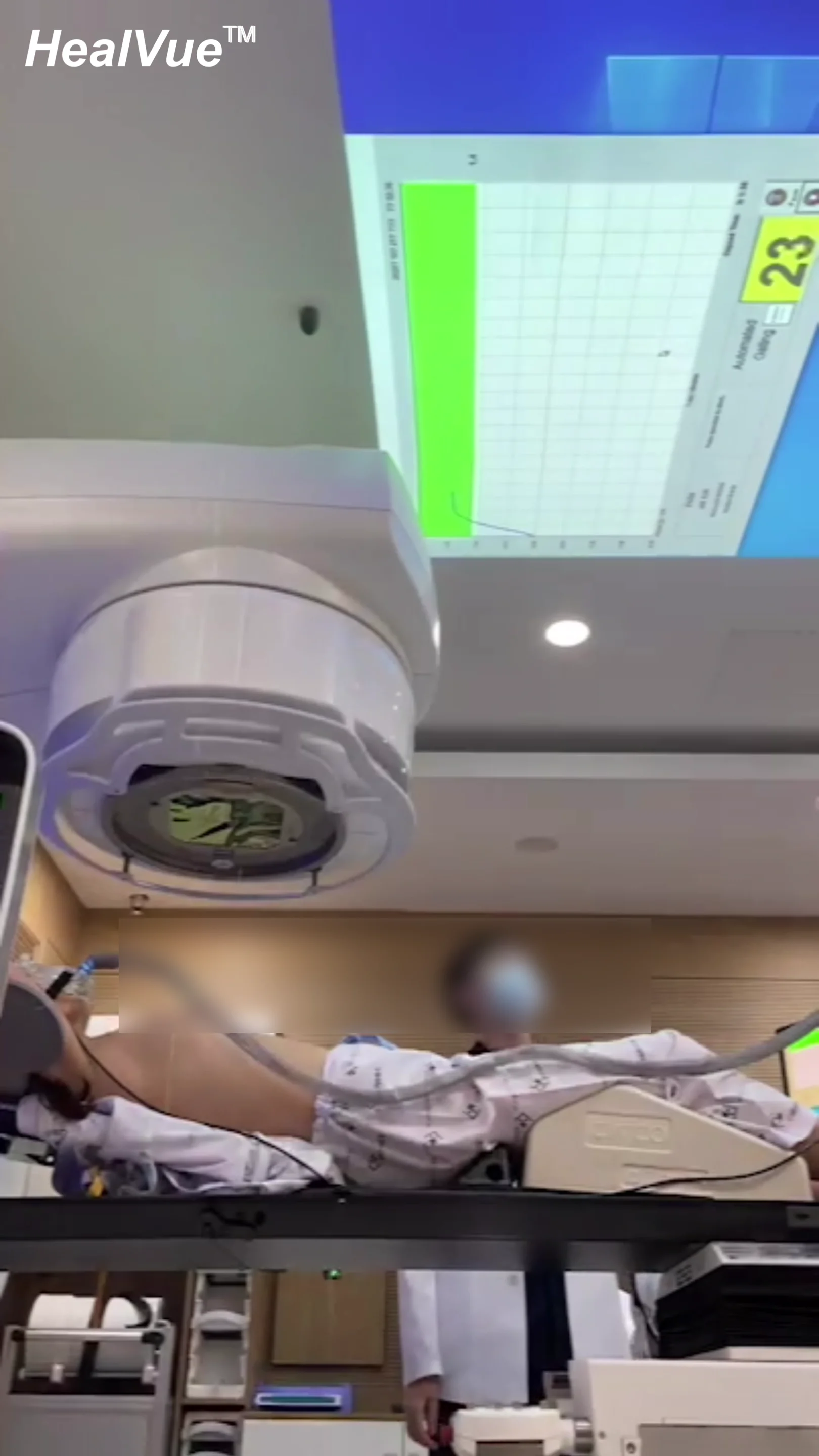 HealVue@Elekta ABC Respiration Gating Interface