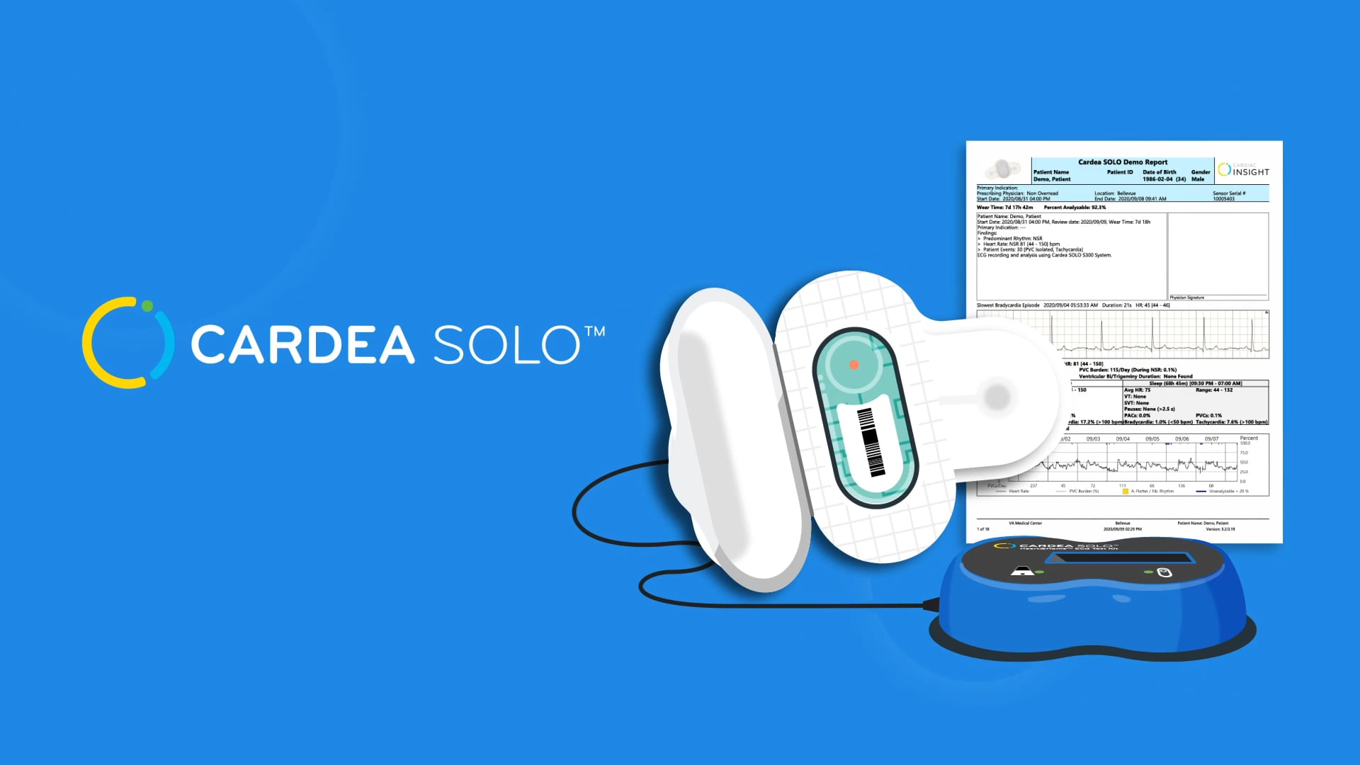 Cardea SOLO ECG Explainer Video on Vimeo