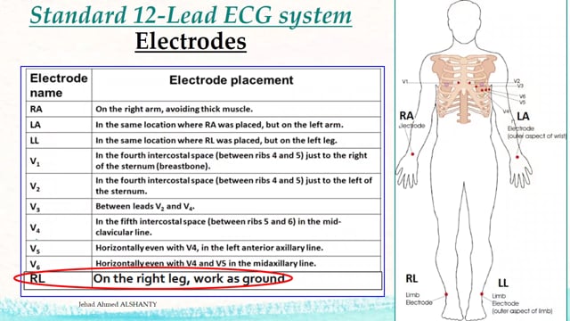Electrocardiography - ECG Signal Detection - الفيزياء الحيوية | Najah ...