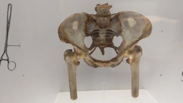 Pelvis, Vertebral Column, Anatomy. Free Stock Video - Pixabay