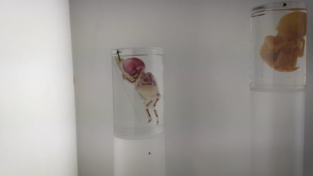 Baby Pregnancy Fetus Free Stock Video - Pixabay