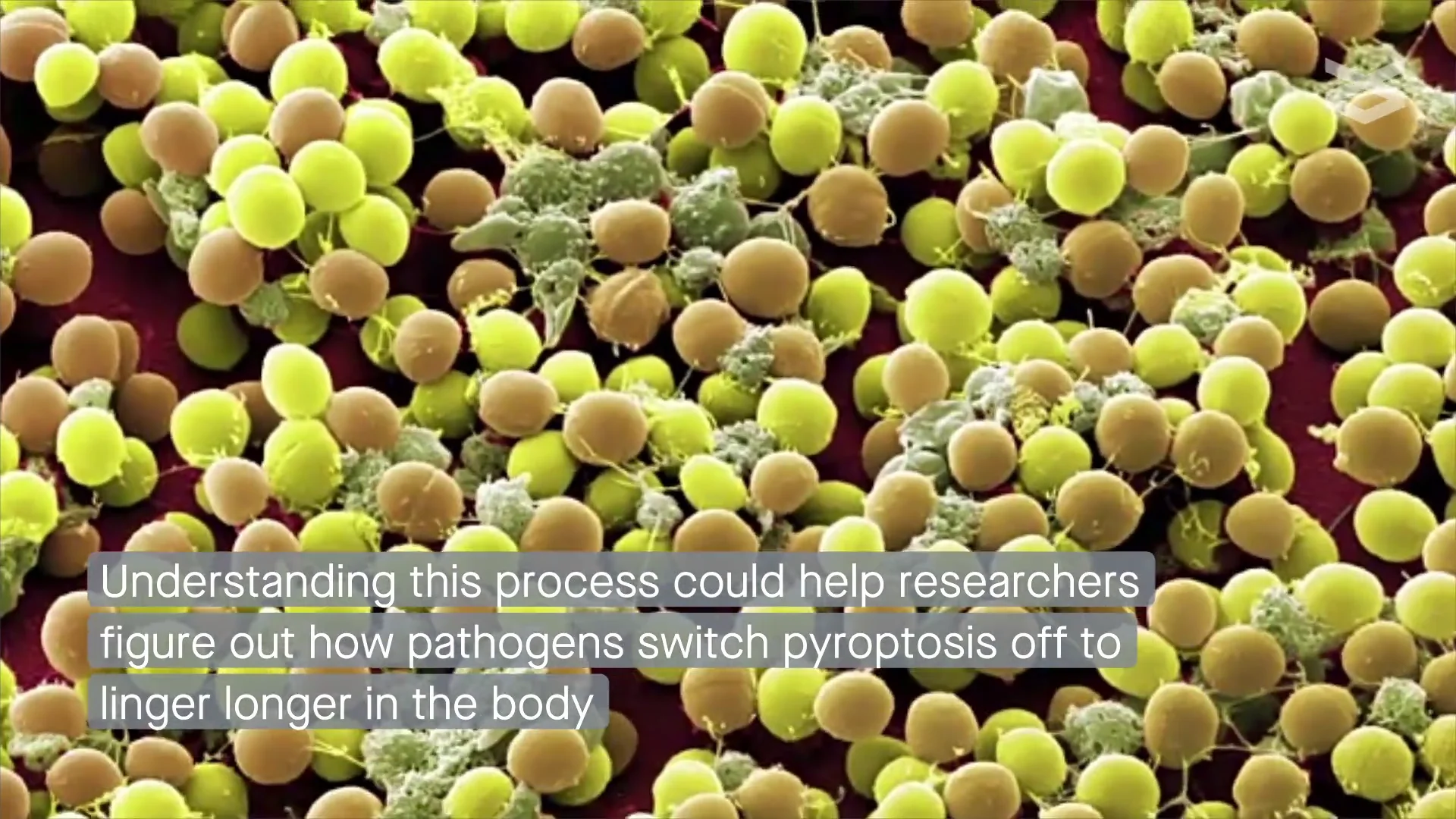 How staph infections trigger cell death in human immune cells