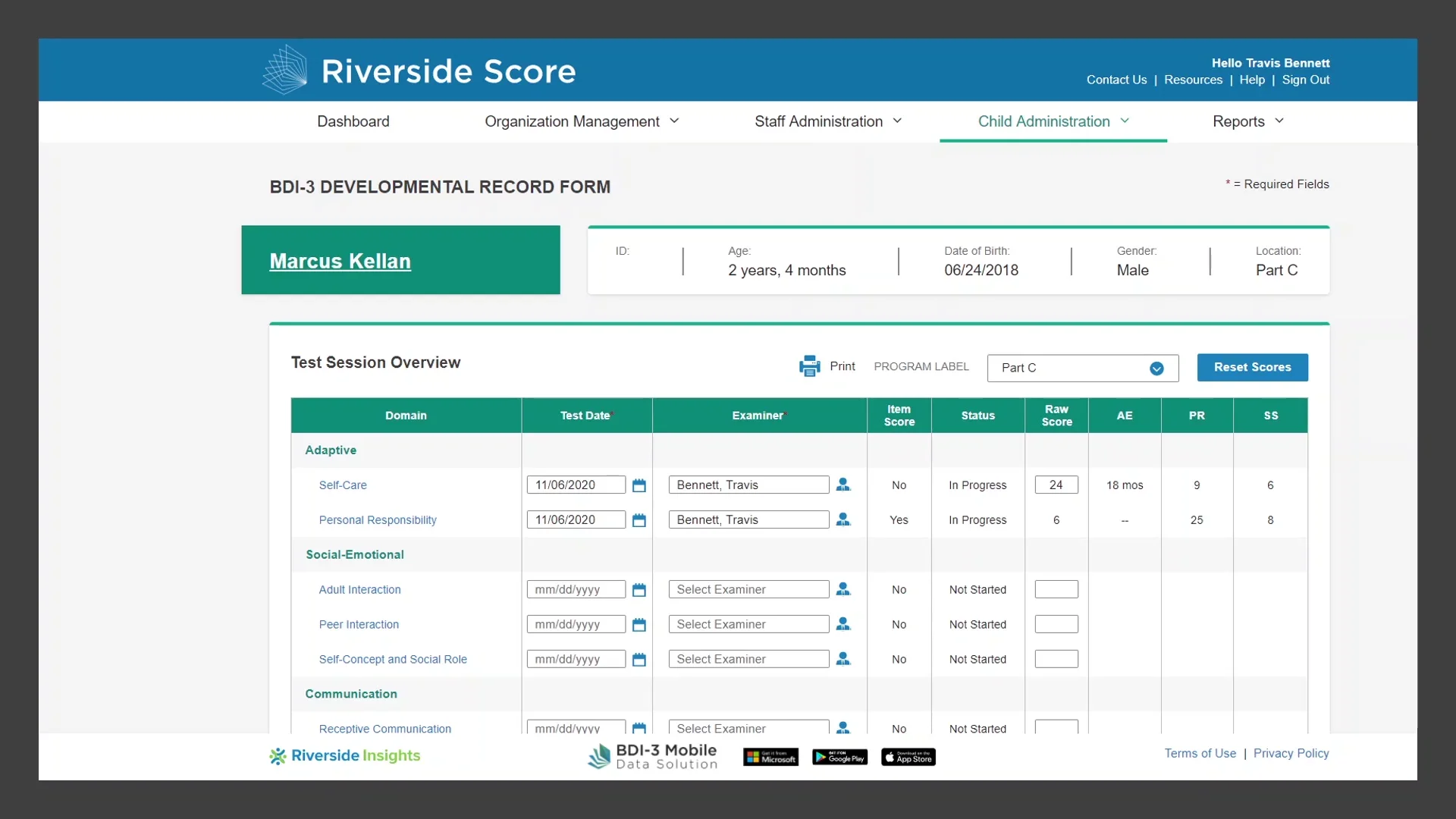 Using Riverside Score for BDI-3