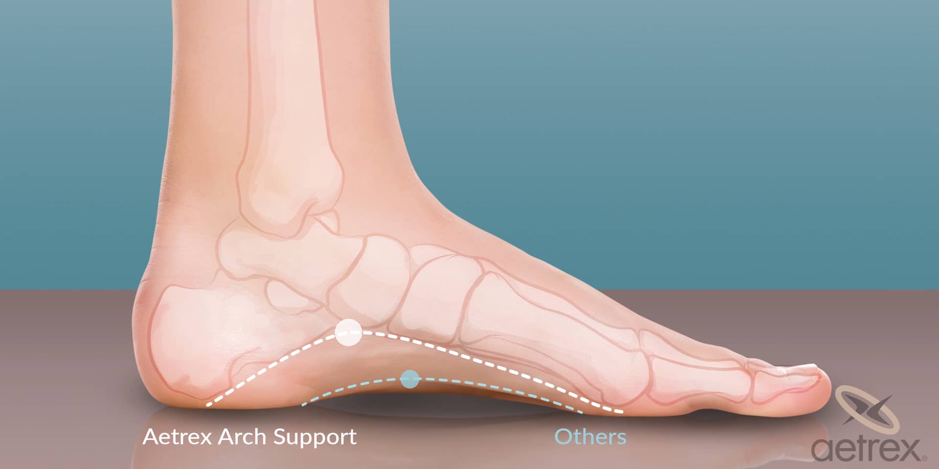 The Aetrex Advantage - Arch Support on Vimeo